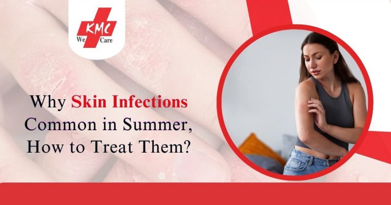 Why Are Skin Infections More Common in Summer and How to Treat Them?